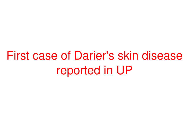 First case of Darier's skin disease reported in UP - Social News XYZ